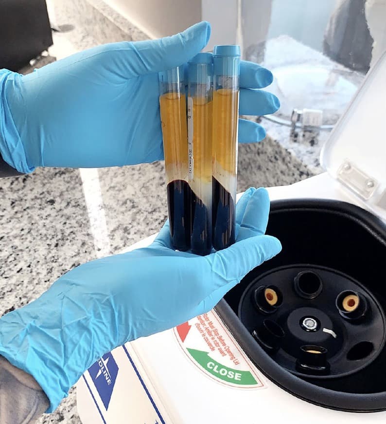 Micro-Needling | Relive Viera - The Best Anti-Aging Medical Clinic in ...